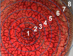 Dried Blood Analysis - Live Blood Online