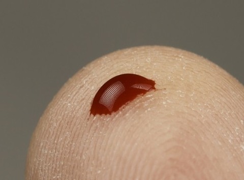 Live Blood Analysis (Naturopathic Microscopy) – How does it work?